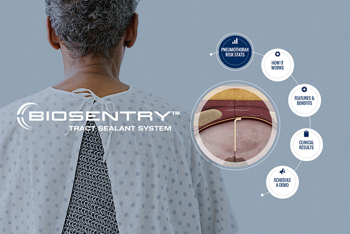 Biosentry | Medical Device Marketing Agency | The Matchstick Group